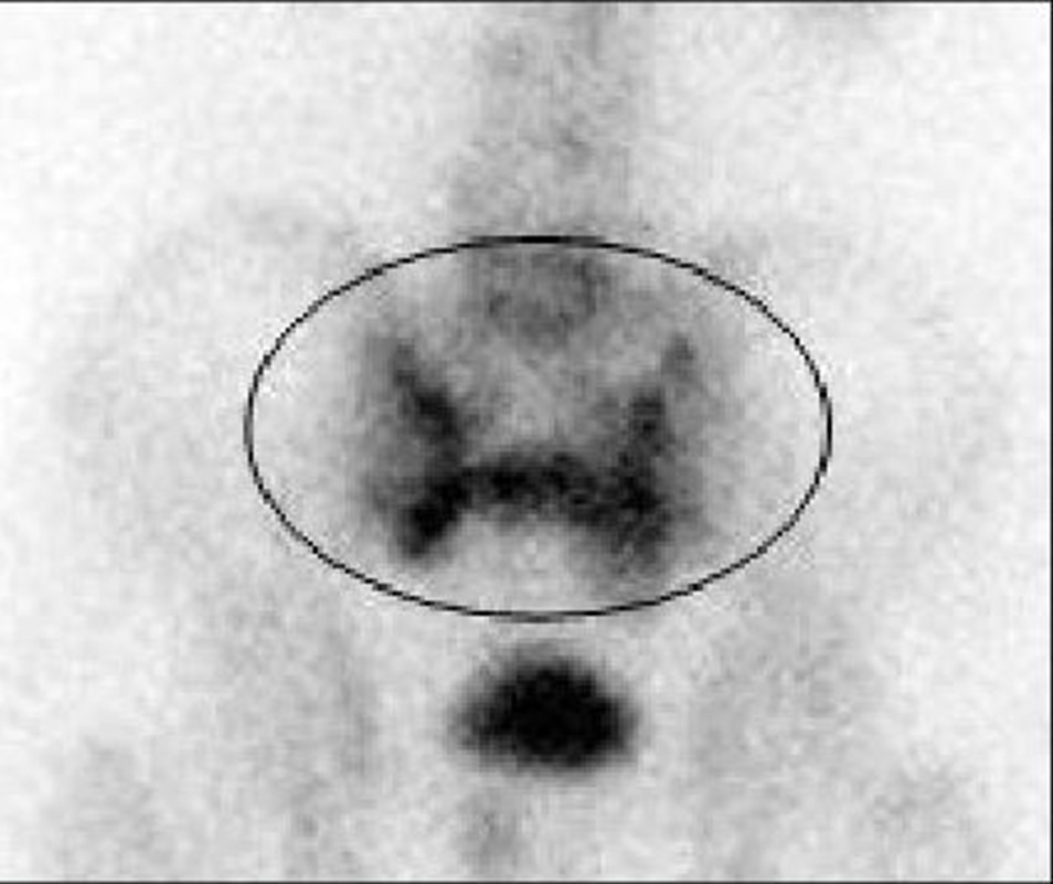 The ‘H’ or ‘Honda’ Sign | HSU Clinical & Rehabilitation Services