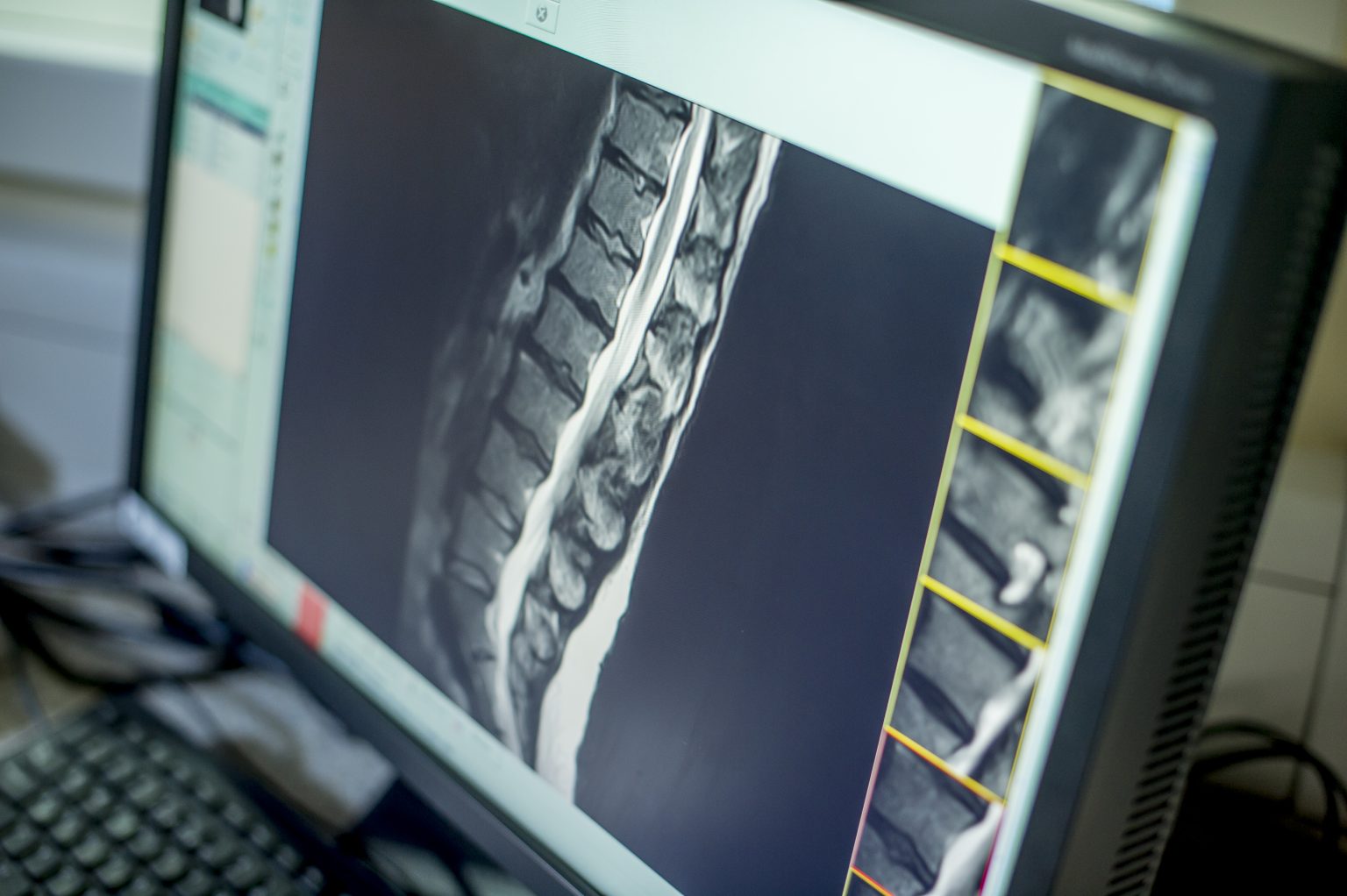 Open Upright MRI | HSU Clinical & Rehabilitation Services