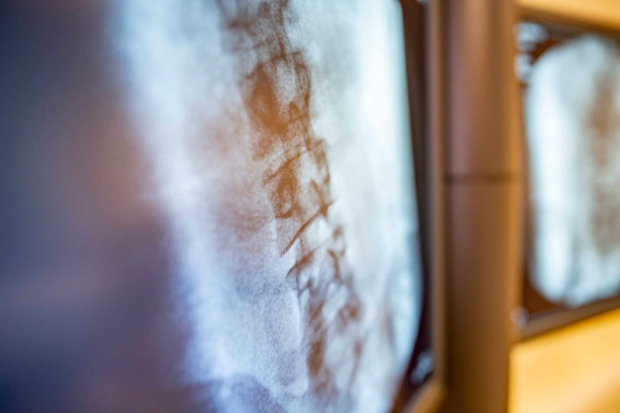 X-ray | HSU Clinical & Rehabilitation Services